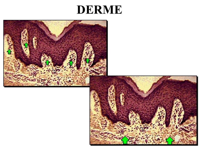 Structure histologique de la peau : le derme - Cheveurama